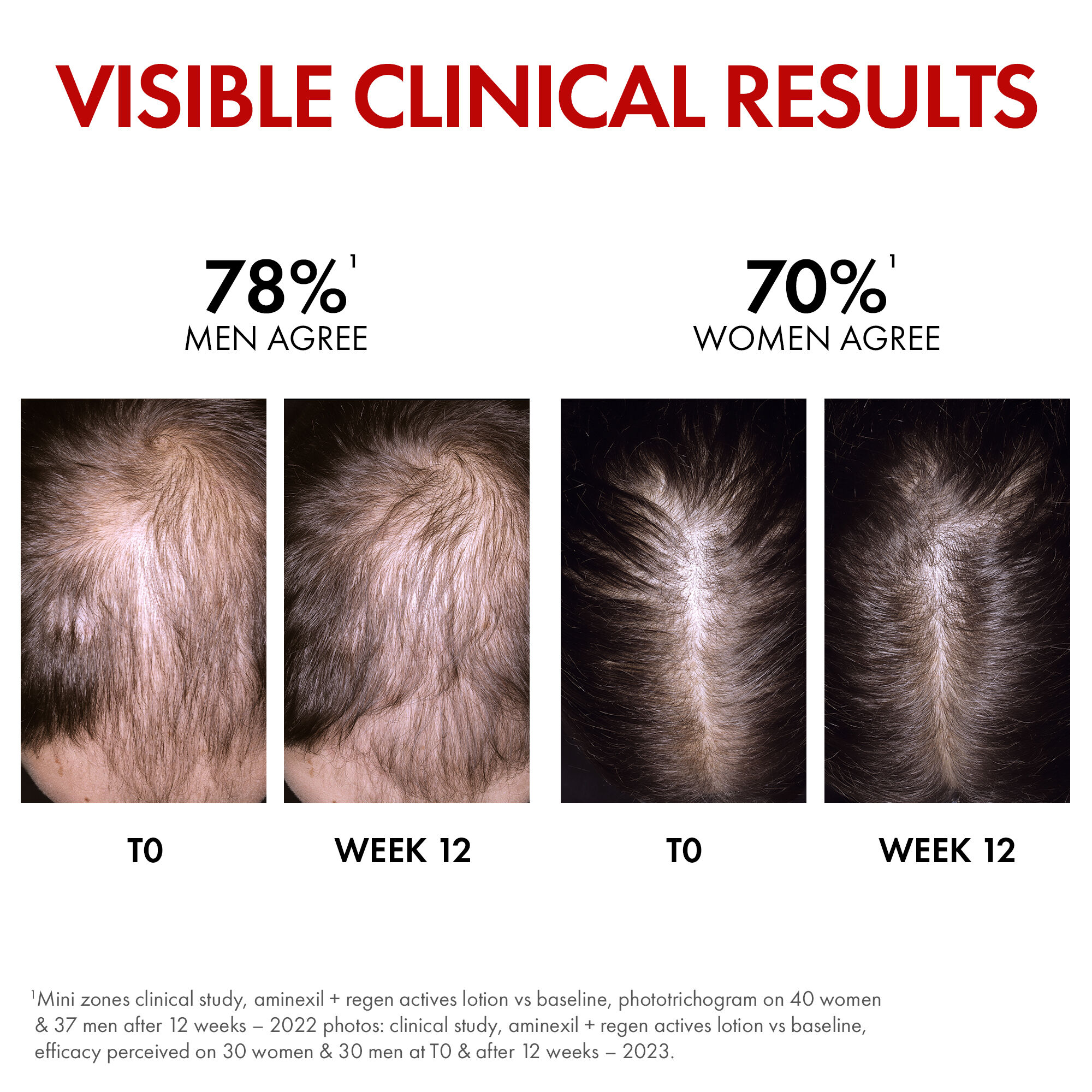 Vichy Canada Dercos Regen Booster Hair Serum